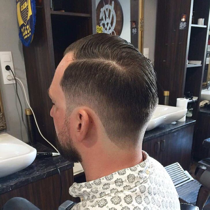 Best Hairstyles for Balding Men to Boost Confidence